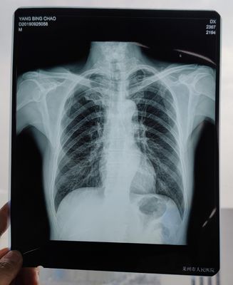Laser X Ray Film factory, Buy good price Medical Dry Film products