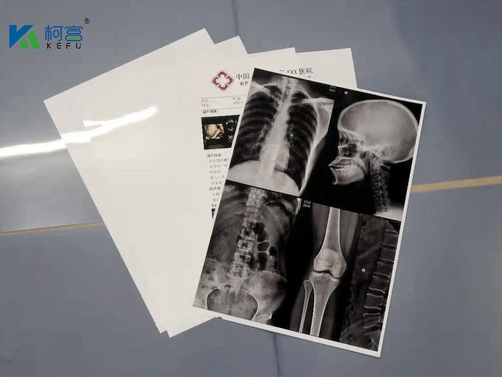 13X17'' White 180 Microns PET X Ray Film Sheets Transparency Film For ...