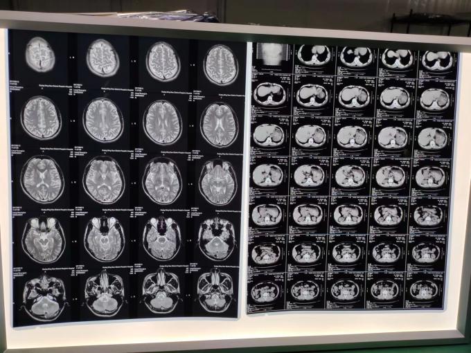 Waterproof 8x10 Inch Inkjet X Ray Film Blue Medical Xray Film 280gsm